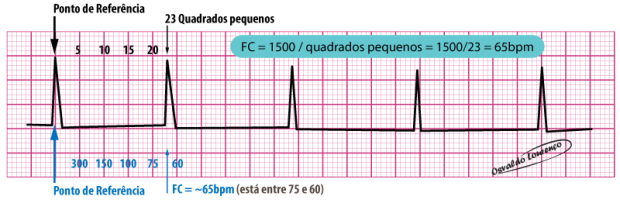Frequência Cardíaca e Amplitude: como determinar no ECG? – ANGOMED NEWS